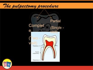 pulpectomy-pedo | PPT