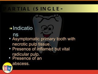 pulpectomy-pedo | PPT