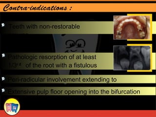 pulpectomy-pedo | PPT