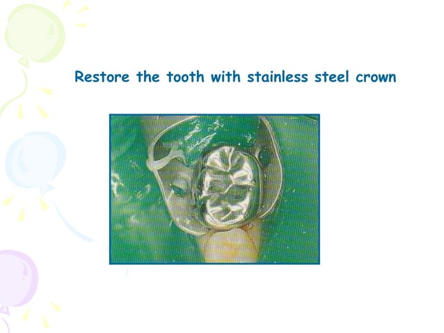 pulpotomy procedures in primary dentition | PPT | Dental Health ...