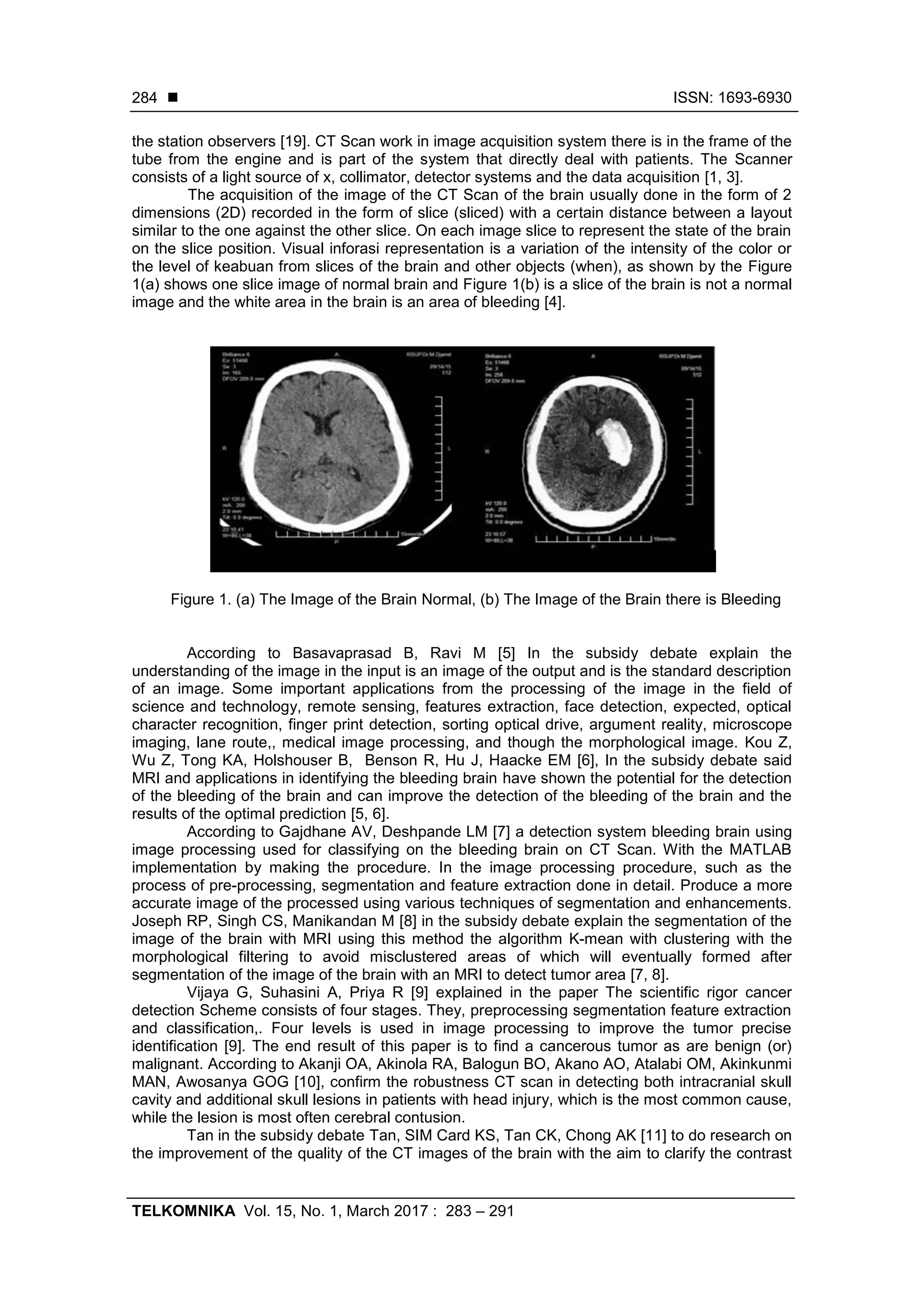 Hybrids Otsu Method, Feature region and Mathematical Morphology for Calculating Volume ...