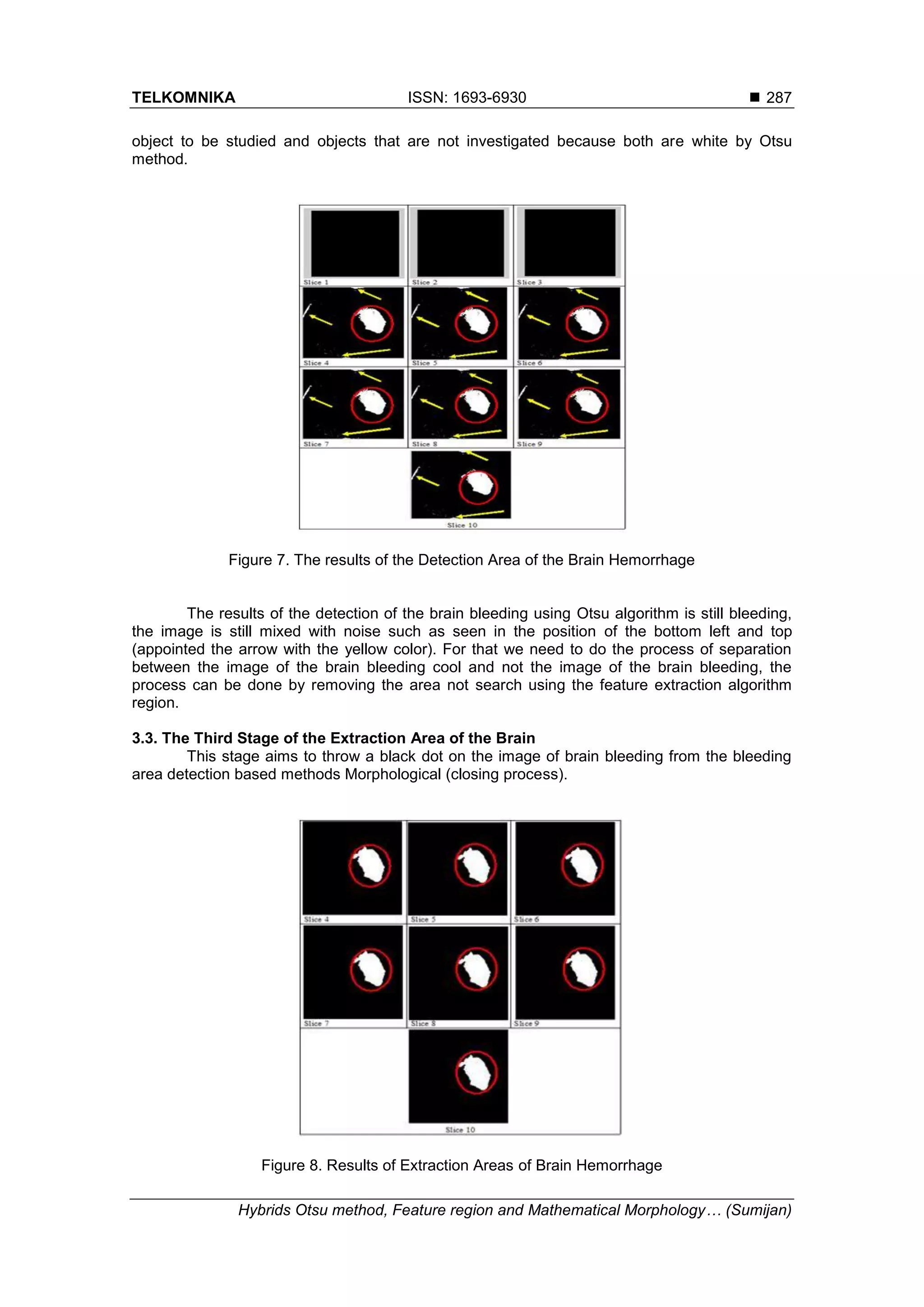 Hybrids Otsu Method, Feature region and Mathematical Morphology for ...