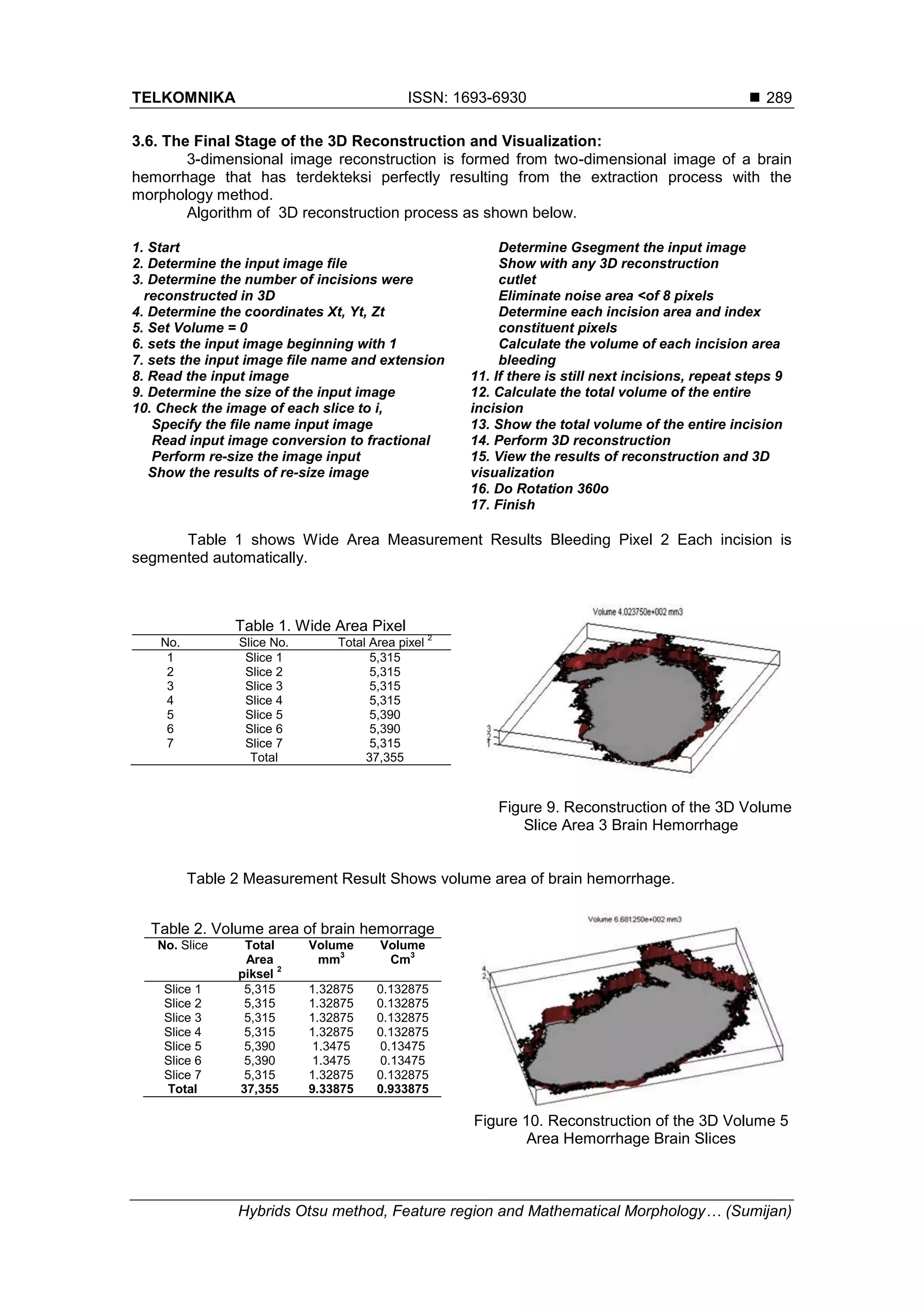 Hybrids Otsu Method, Feature region and Mathematical Morphology for Calculating Volume ...