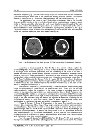 Hybrids Otsu Method, Feature region and Mathematical Morphology for ...