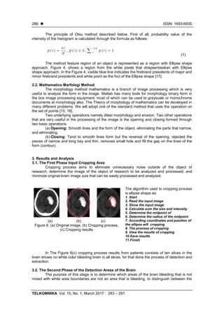 Hybrids Otsu Method, Feature region and Mathematical Morphology for ...