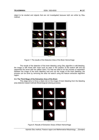 Hybrids Otsu Method, Feature region and Mathematical Morphology for Calculating Volume ...
