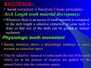 serial extraction | PPT