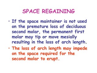 space-regaining-pedo | PPT