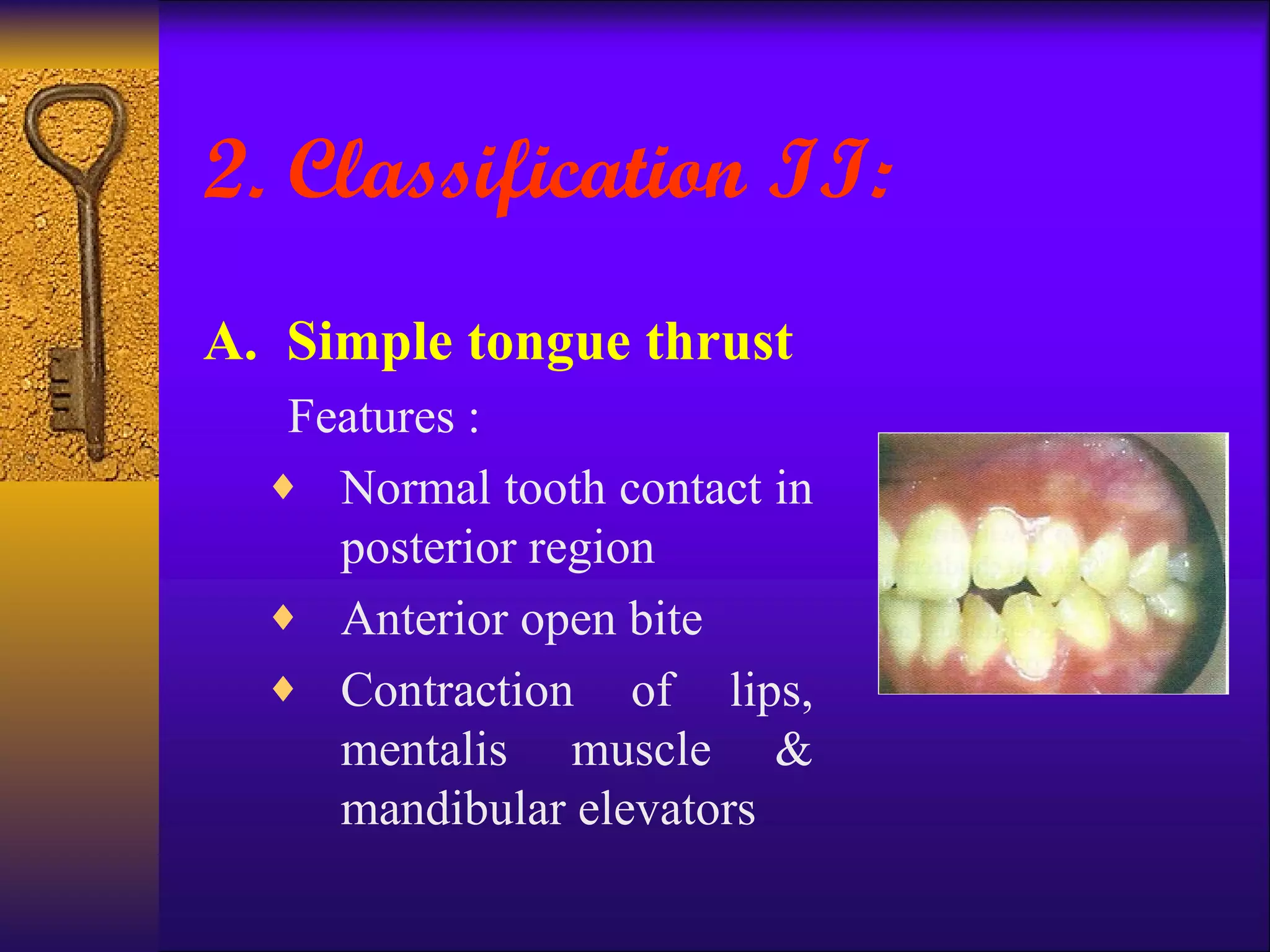 tongue-thrusting | PPT