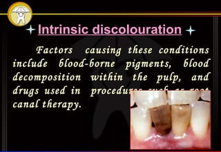 tooth-discolouration-pedo | PPT