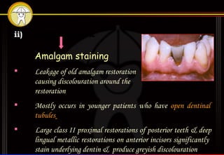 tooth-discolouration-pedo | PPT