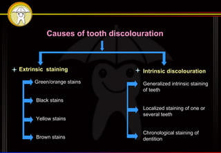 tooth-discolouration-pedo | PPT