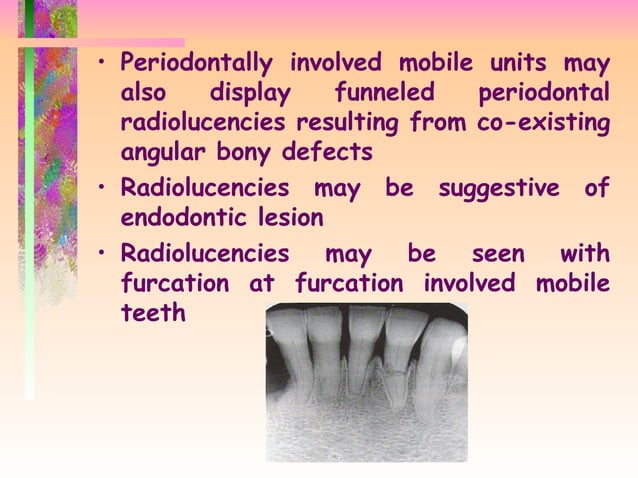 tooth-mobility-pedo | PPT