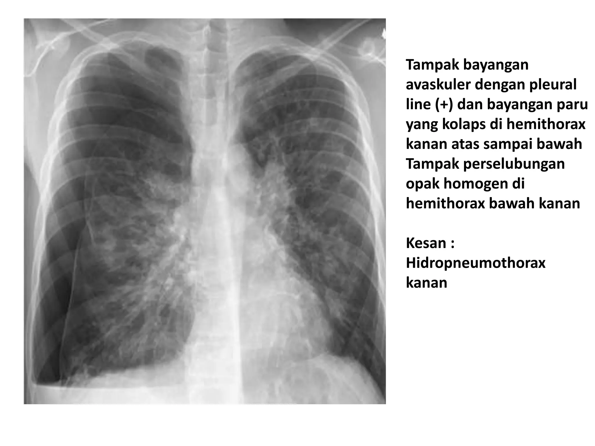 323540465-EKSPERTISE-RADIOLOGI(2).pptx