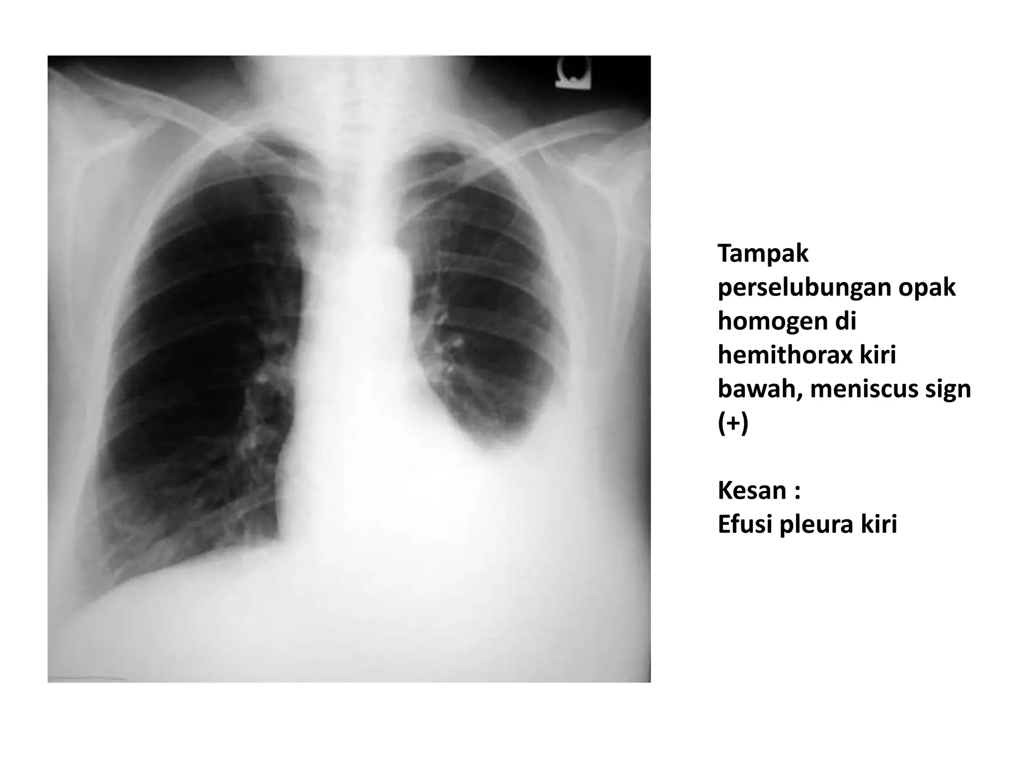 323540465-EKSPERTISE-RADIOLOGI(2).pptx