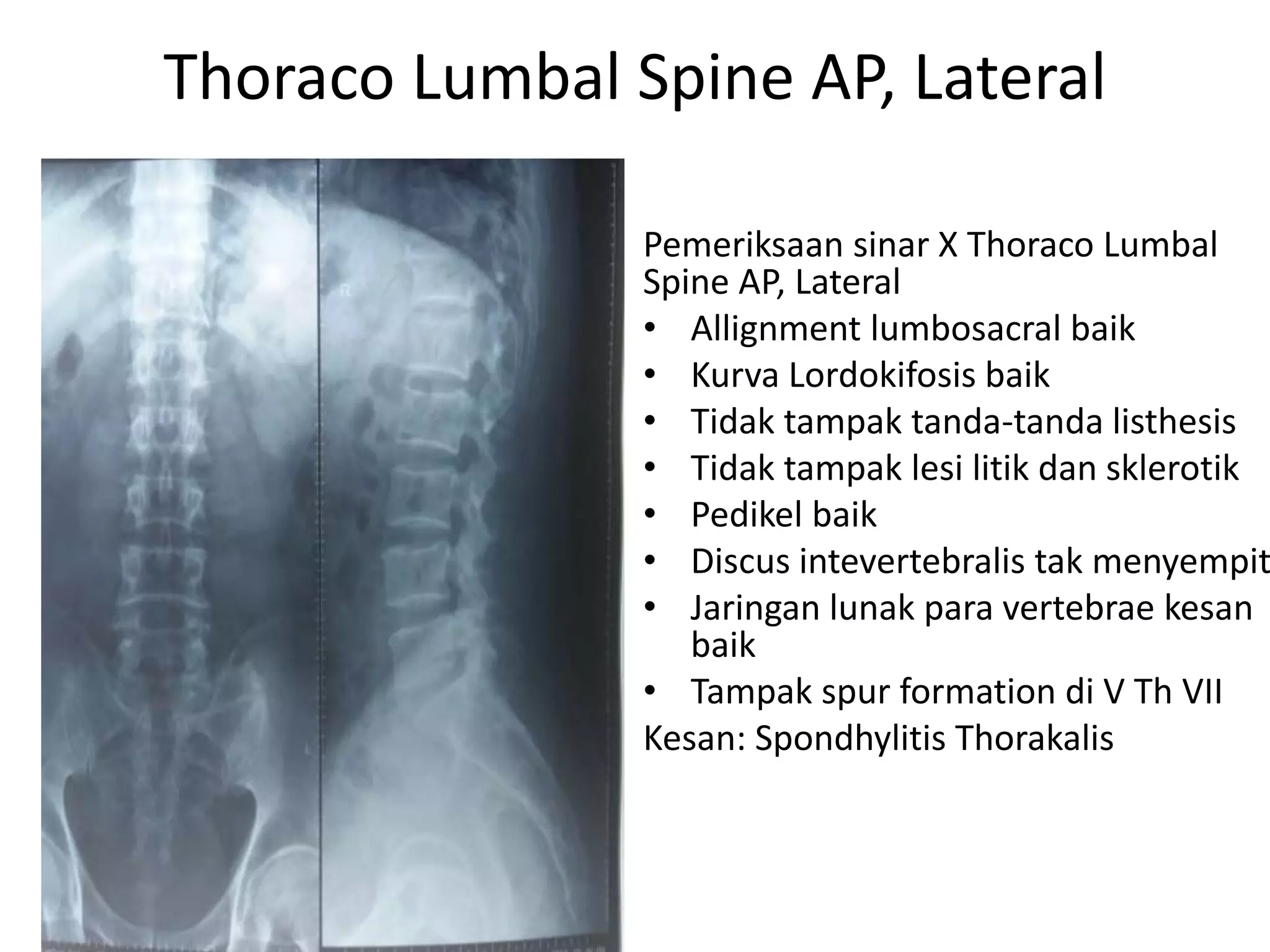 323540465-EKSPERTISE-RADIOLOGI(2).pptx