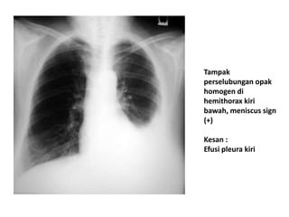 323540465-EKSPERTISE-RADIOLOGI(2).pptx