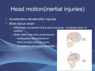 324 Biomechanical basis of TBI | PPTX | First Aid | Injuries