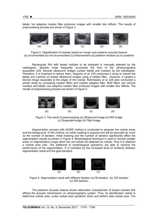 Computer Aided Diagnosis using Margin and Posterior Acoustic ...