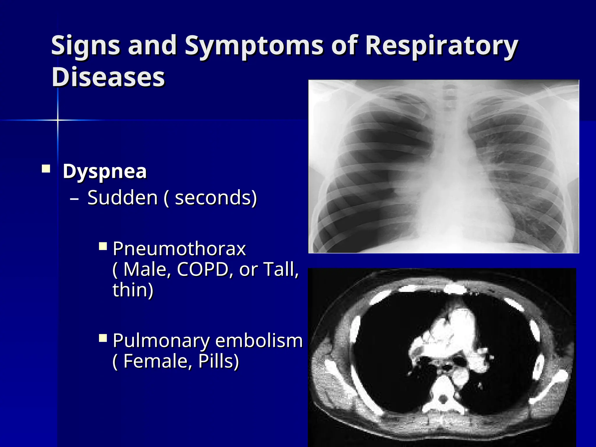 32792_Signs and Symptoms of Respiratory Diseases.ppt