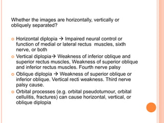 approach to diplopia 3.11.2017