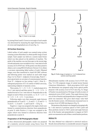 Achint thesis | PDF | Dental Health | Diseases and Conditions