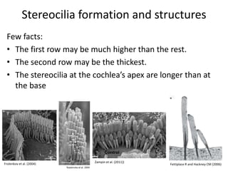 Modeling the shapes of actin based protrusions (stereocilia, filopodia ...