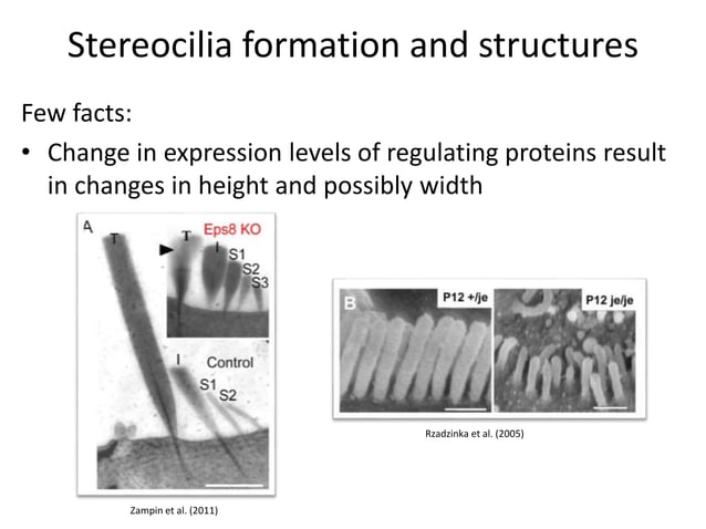 Modeling the shapes of actin based protrusions (stereocilia, filopodia ...