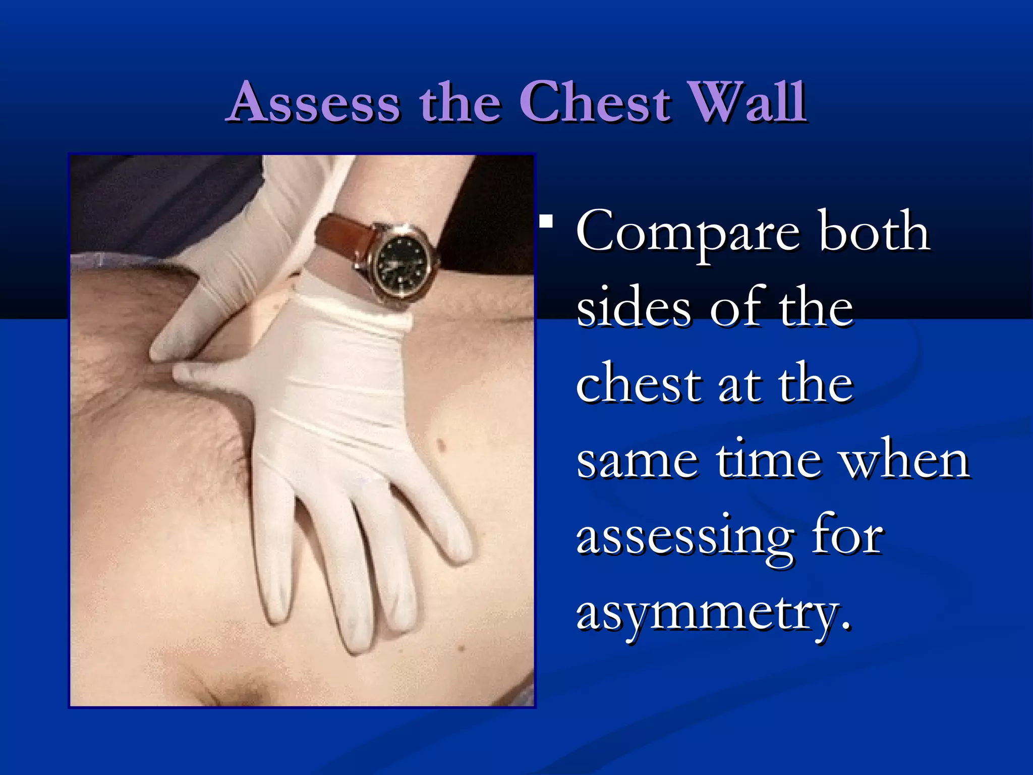 chest trauma management | PPT