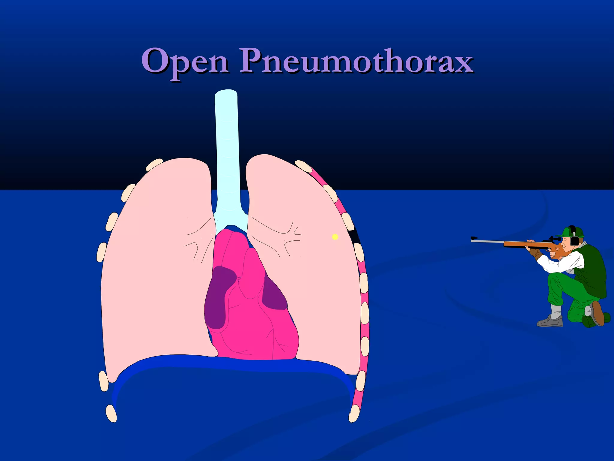 chest trauma management | PPT