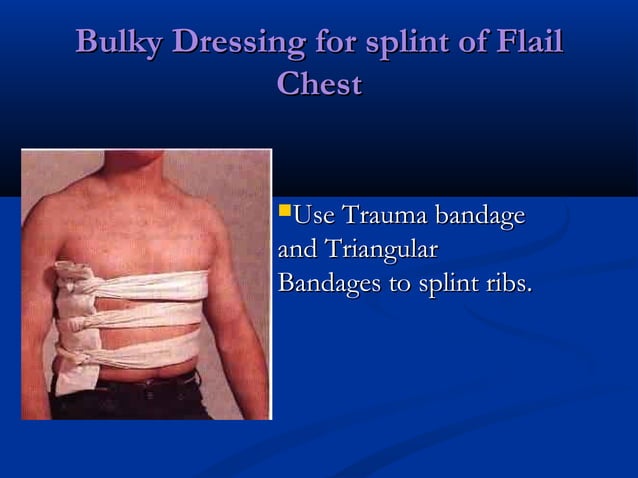 chest trauma management | PPT