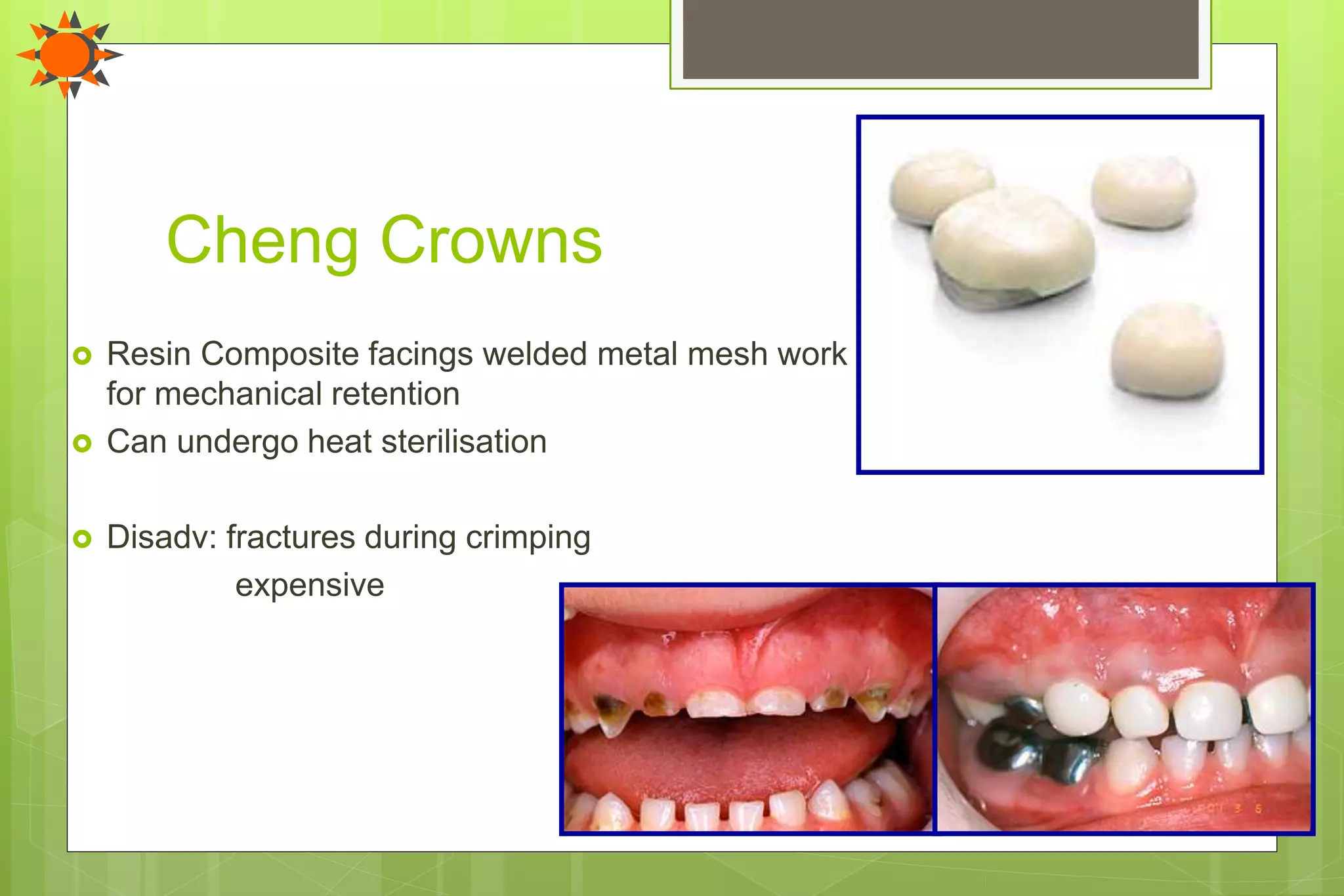Crowns in pediatric dentistry.ppt