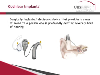 Cochlear Implants in Children. | PPT