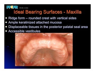 32(new).preprosthetic surgical procedures (n) | PPT