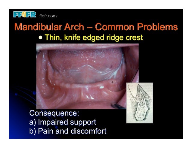 32(new).preprosthetic surgical procedures (n)