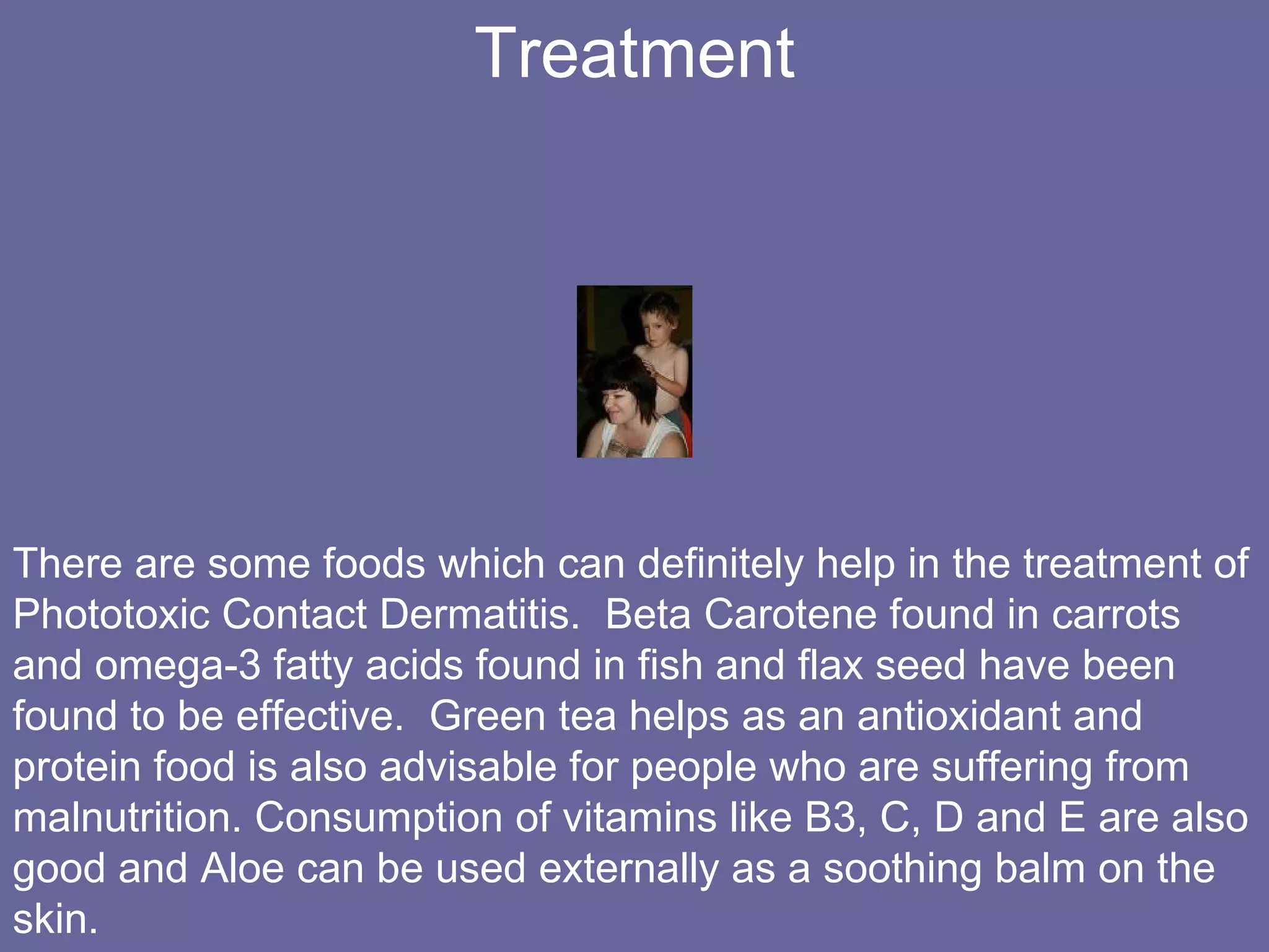 Phototoxic Contact Dermatitis is Similar to Sunburn | PPT