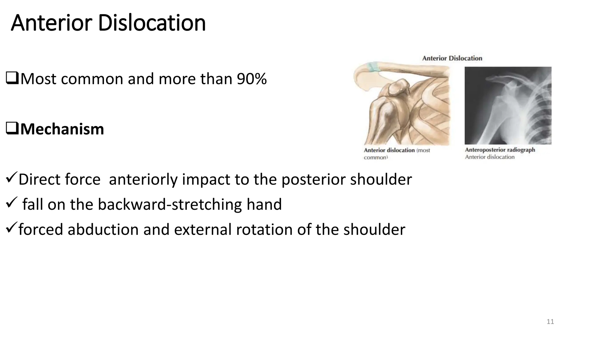 32,Principles of Dislocation Manangment.pptx