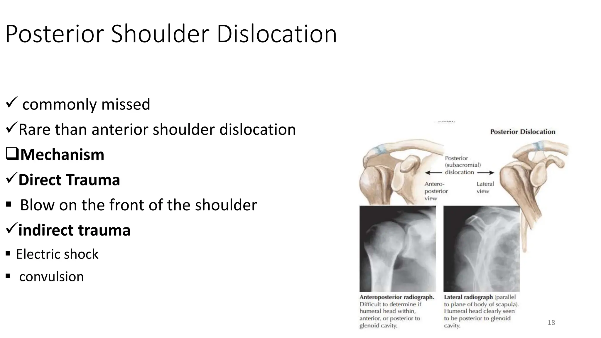 32,Principles of Dislocation Manangment.pptx