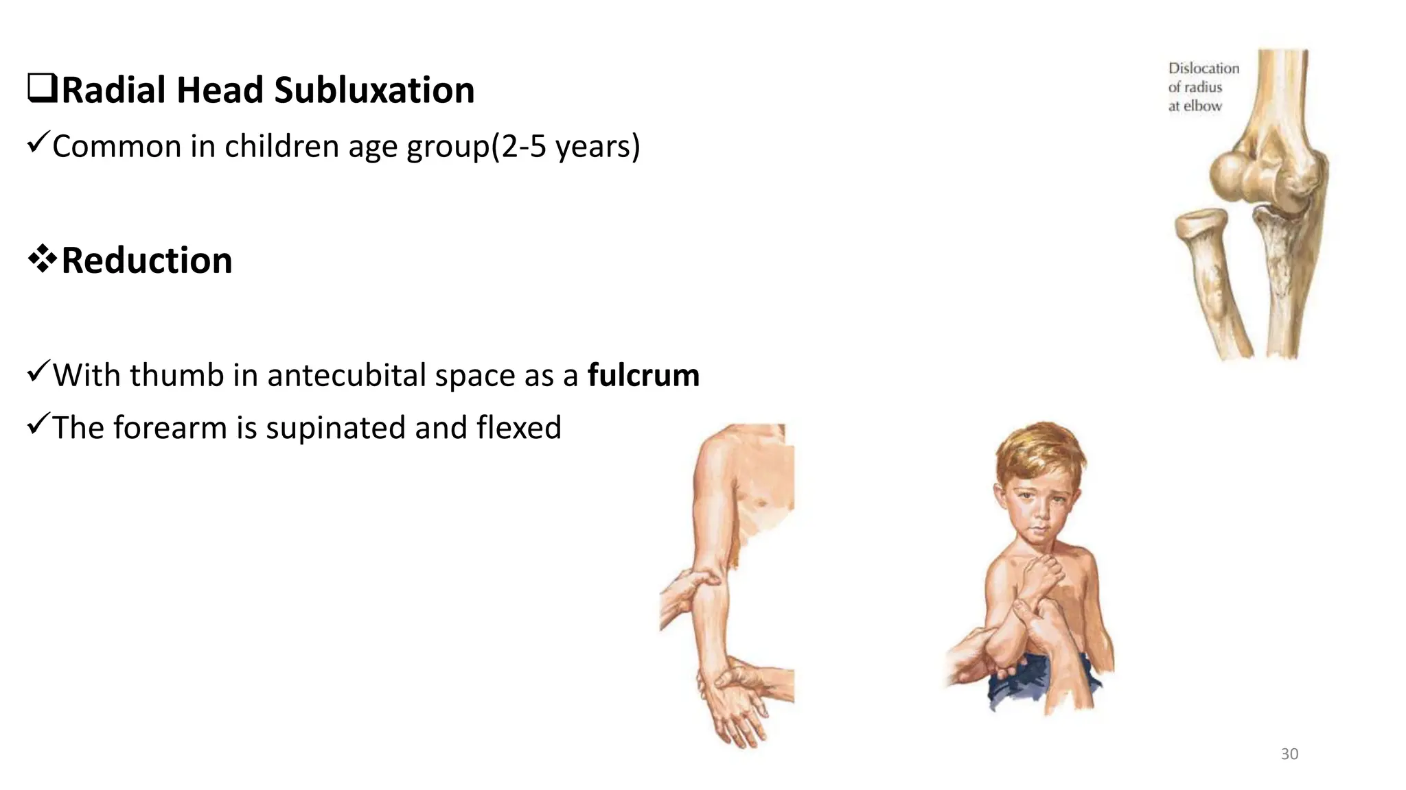 32,Principles of Dislocation Manangment.pptx