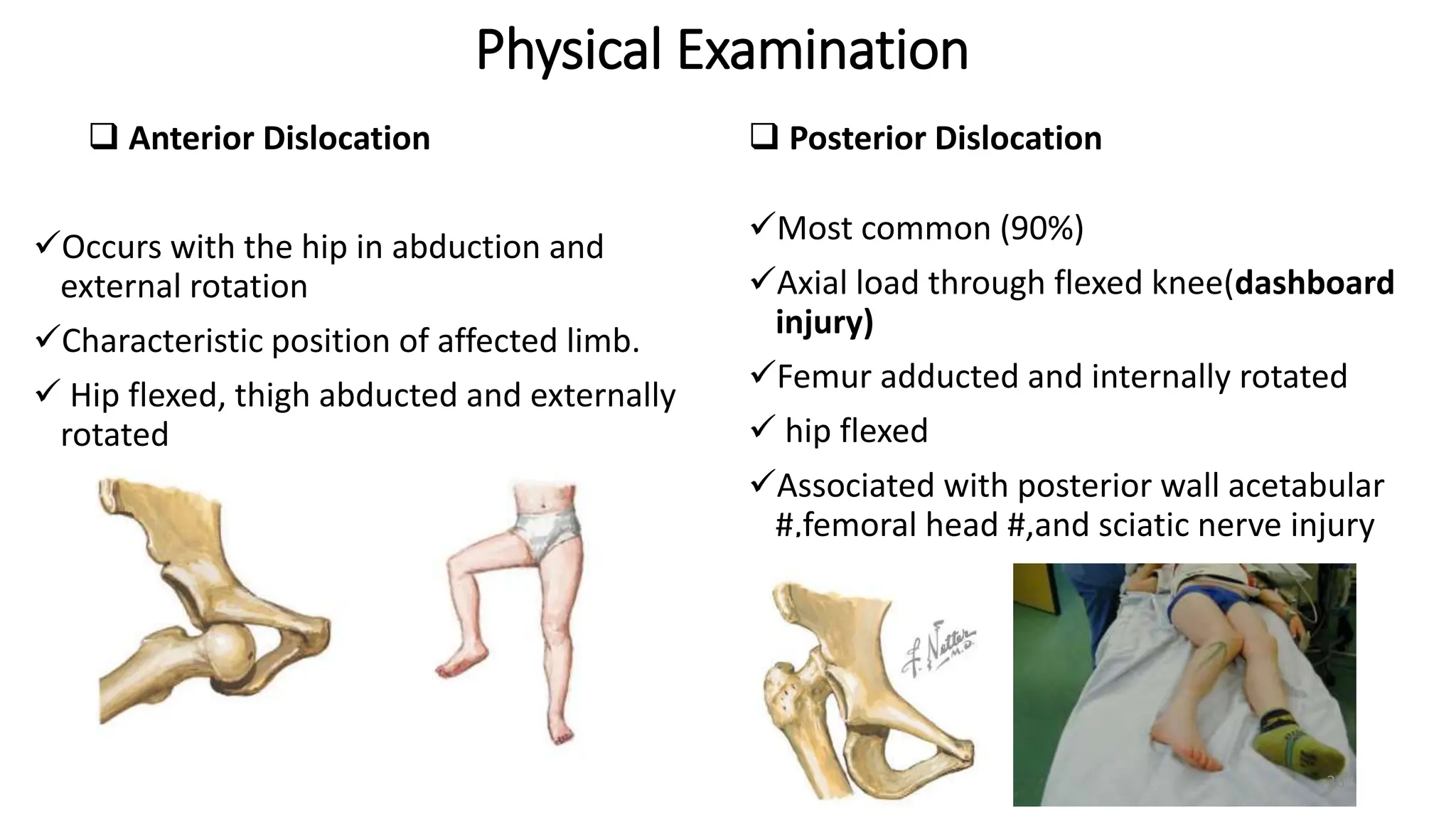32,Principles of Dislocation Manangment.pptx