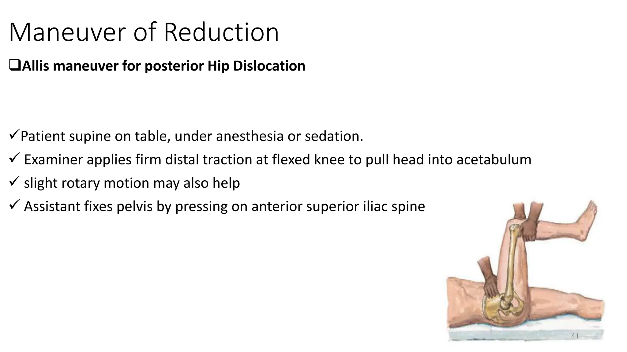 32,Principles of Dislocation Manangment.pptx