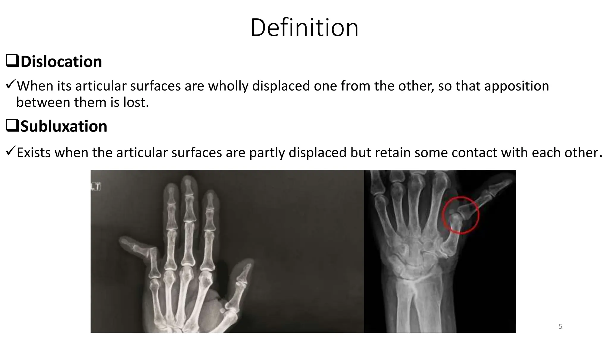 32,Principles of Dislocation Manangment.pptx