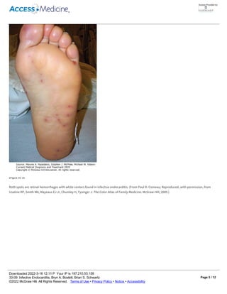 33-09_ Infective Endocarditis.pdf | Heart and Cardiovascular Diseases ...