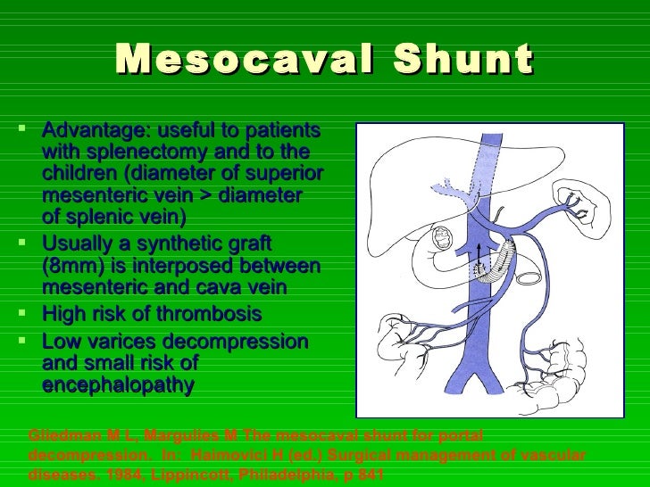 Surgical Anatomy The Mesocaval Shunt