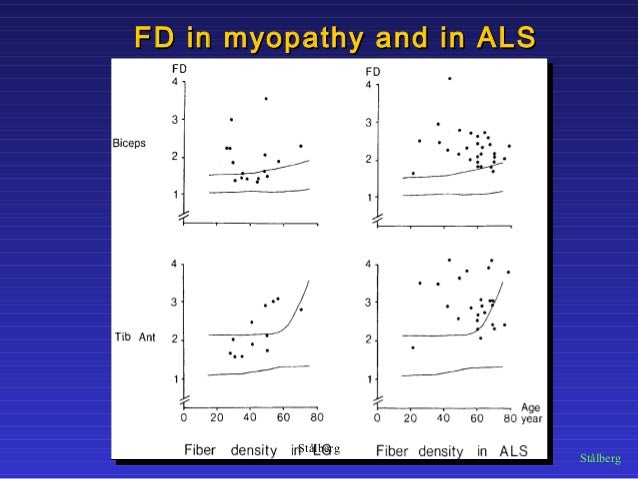 33. SFEMG in diseases