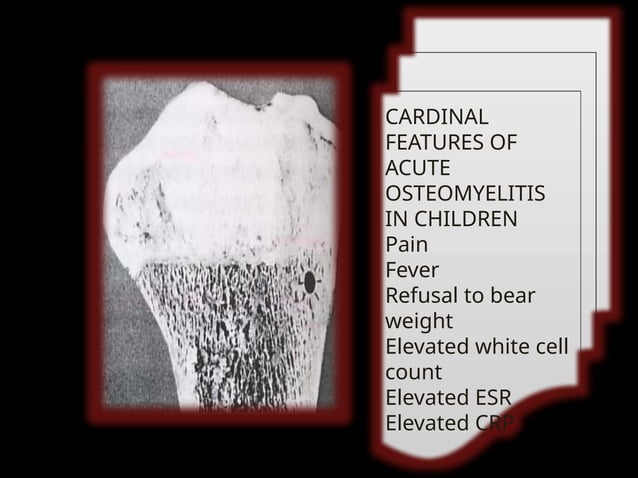 Acute hematogenous osteomylitis ttt and complications.pptx