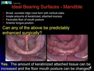 33.reconstructive preprosthetic surgery (n) | PPT