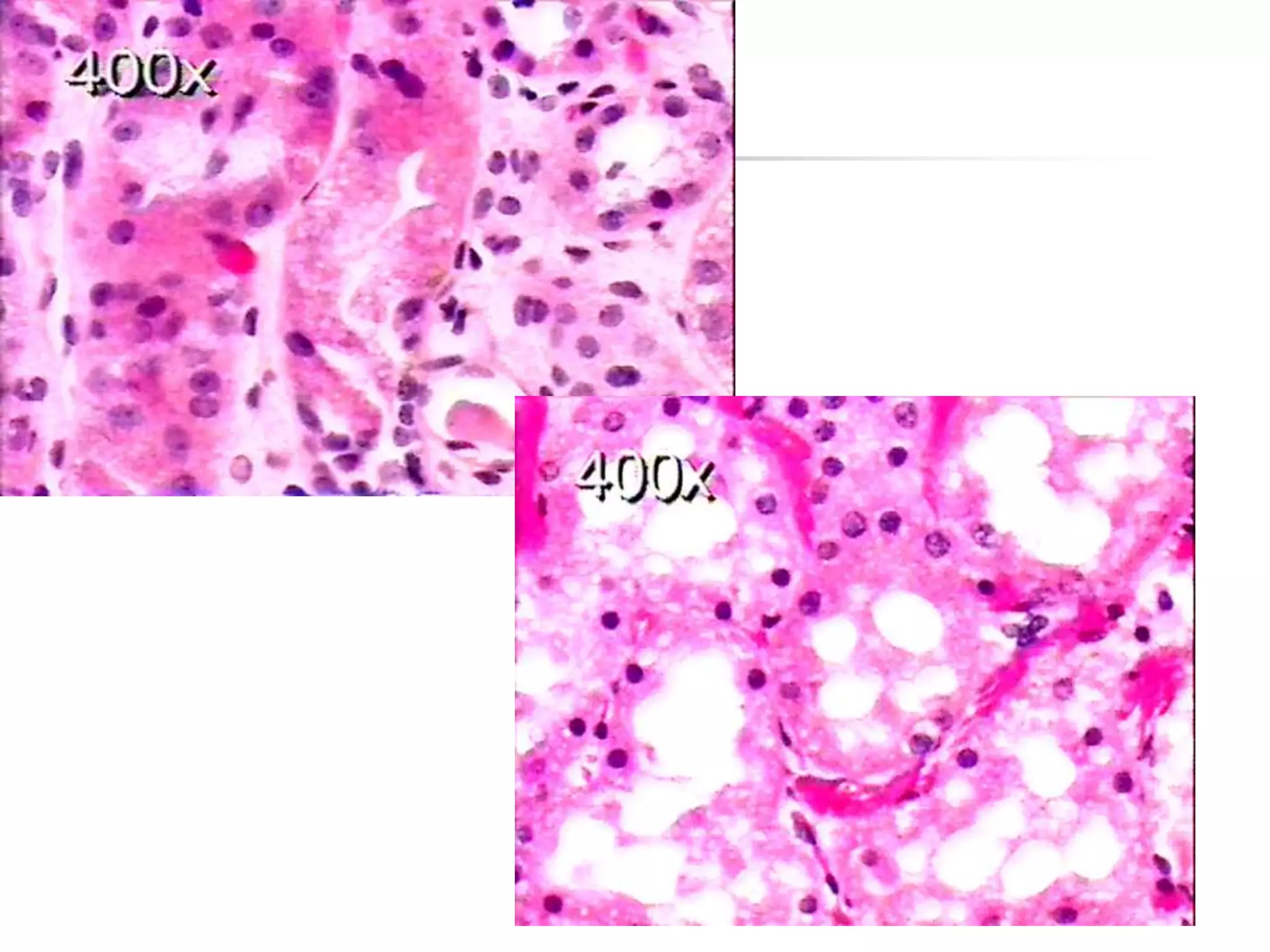forms and morphology of cell injury | PPT