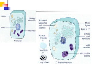 forms and morphology of cell injury | PPT