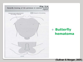330915782 trauma-urethra-pptx | PPTX